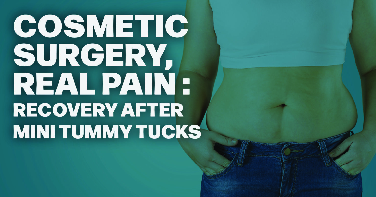 Cosmetic Surgery, Real Pain – Recovery After Mini Tummy Tucks ...